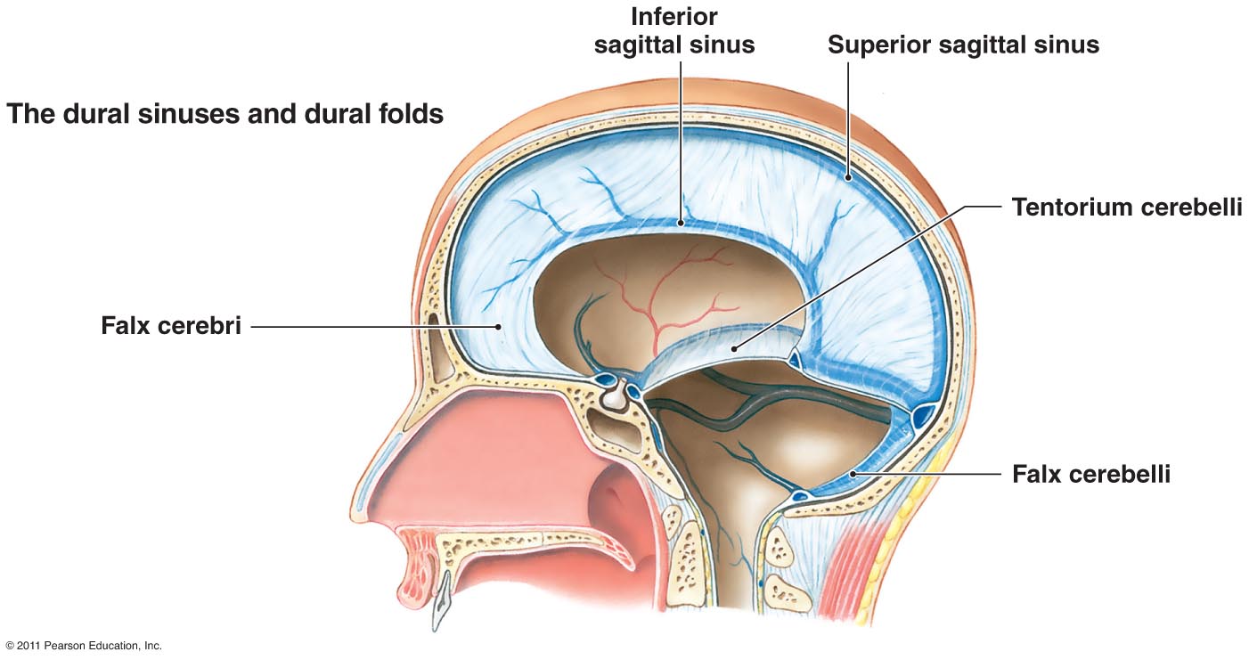 Meninges Dura Mater in General RANZCRPart1 Wiki Fandom Powered By meninges-dura-mater-in-general-ranzcrpart1-wiki-fandom-powered-by