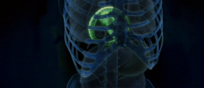 Image - Chestburster X-ray.png | Xenopedia | Fandom powered by Wikia