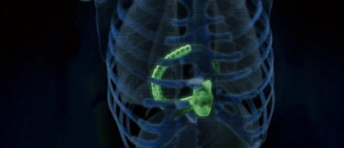Image - Chestburster X-ray (2).png | Xenopedia | Fandom powered by Wikia