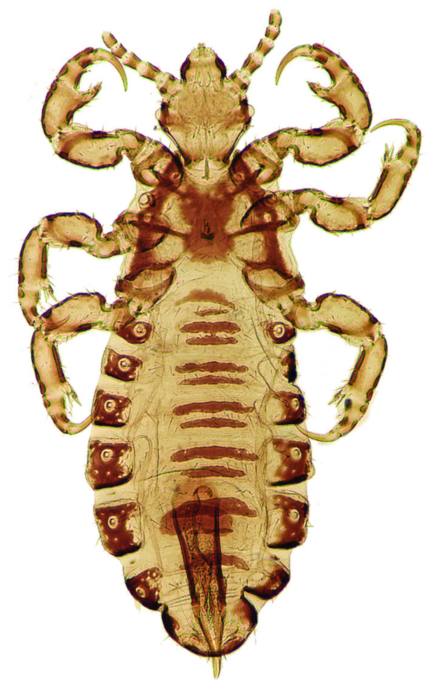 Image Pediculus Humanus Capitis jpg Insect Wiki FANDOM Powered By image-pediculus-humanus-capitis-jpg-insect-wiki-fandom-powered-by